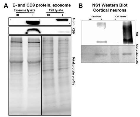 Detection Of Lgtv Proteins In Exosomes Of Primary Cultures Of Cortical