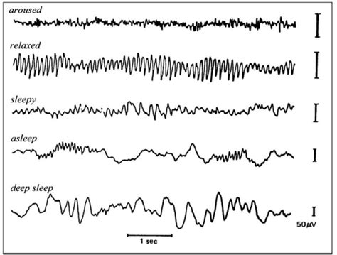 11eeg Waveforms For Different Physical States 39 Download Scientific Diagram