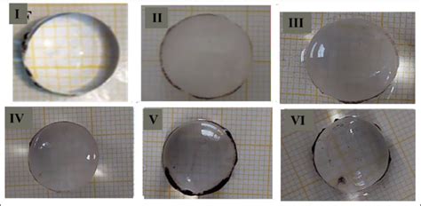 Photograph Images Depicting The Reduced Cataract Opacity After The Download Scientific Diagram
