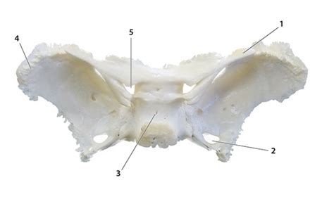 Sphenoid Bone Superior Diagram Quizlet