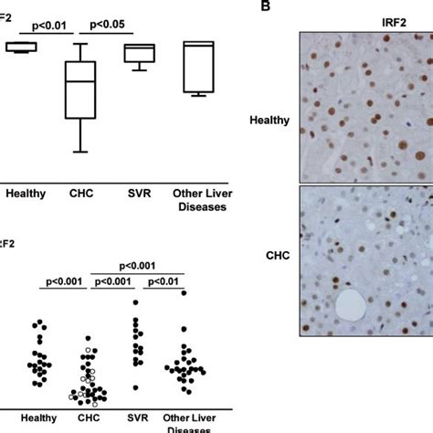 Interferon Regulatory Factor 2 Irf2 Expression In Human Liver A