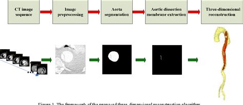 Figure 1 From Segmentation Of The Aortic Dissection From Ct Images