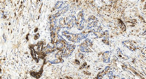 Icam 1cd54 Antibody 30806 1 Ap Proteintech