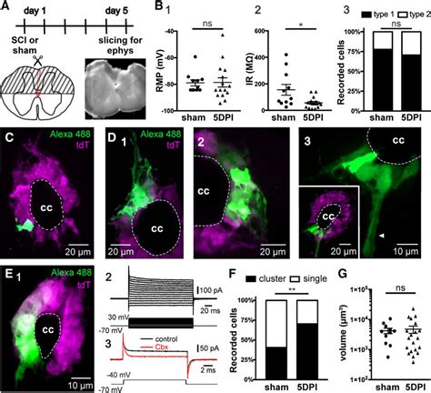 Injury Increases Gap Junction Coupling Between Ependymal Cells Of The