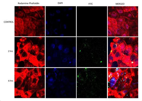 Confocal Microscopy Images Of Caco 2 Cells After 6 H Incubation At 37