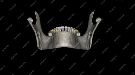 Premium Photo The Mandibular First Molar Usually Has Two Roots A