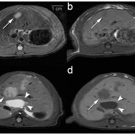 30t Axial Mr Imaging Of Non Ligated Control And Common Bile Duct