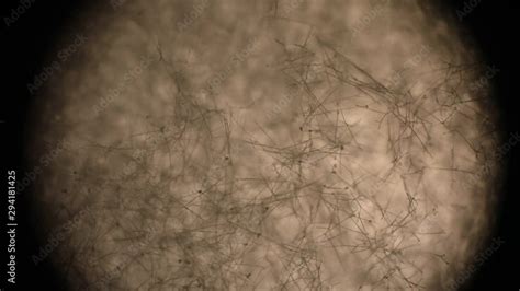 Botrytis Cinerea Hyphae Seen Under A Microscope During A