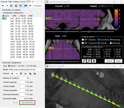 Tutorialsieegcontactlocalization Brainstorm