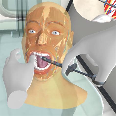 A Snapshot Of The Inferior Alveolar Nerve Block Ianb Procedure Being