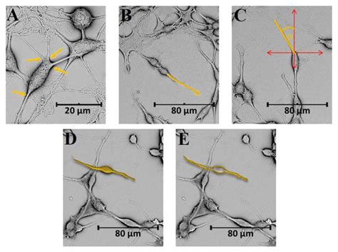 Prokaryotic Cells Under Microscope