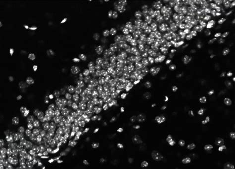 Counting Nuclei With Chromatin Speckles Image Analysis Imagesc Forum