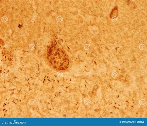 Cerebellum Purkinje Cells Stock Image 220382761