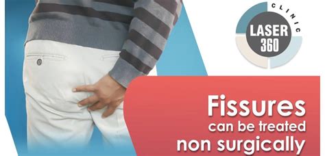 Find Out Some Important Details On Fissure Surgery