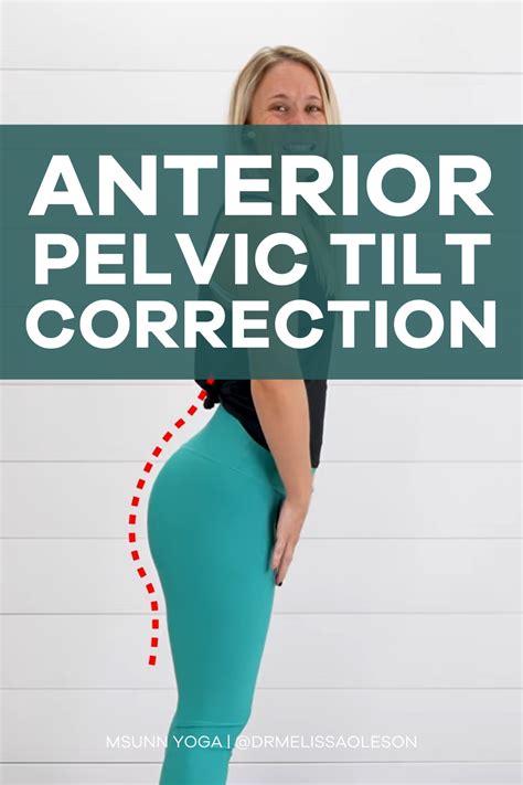 Anterior Pelvic Tilt Correction Yoga Exercises Yoga For Back Pain And