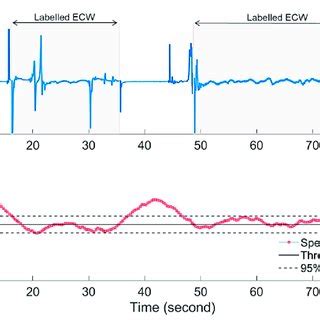 Raw Ppg Signal Upper Graph Showing Signal Regions Including Cardiac