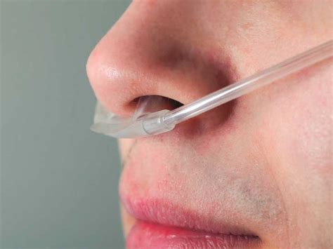 COPD Exacerbation Treatment Options