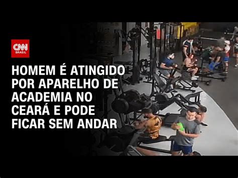 Tomografia Mostra Lesão Na Coluna De Homem Atingido Por Aparelho Em