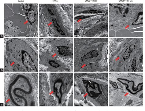 Figure 5 From Nitro Oleic Acid Ameliorates Erectile Dysfunction In A Streptozotocin Induced Rat