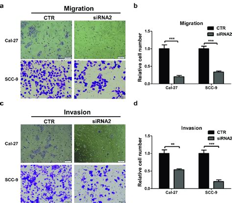 Linc01296 Knockdown Inhibits Hnscc Cell Migration And Invasion In