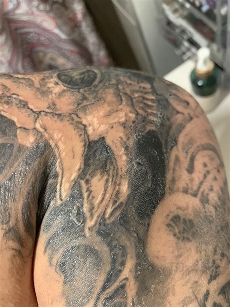 why does little shaded patch look darker r tattooadvice
