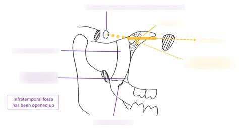 Diagram Of Infratemporal Fossa Opened Up Lateral View Of Md Quizlet