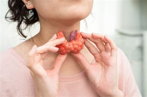 Hyperthyroidism Overactive Thyroid Thyroid Lymphoma Asian Woman With Thyroid Gland Human