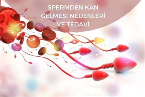 Spermden Kan Gelmesi Nedenleri Ve Tedavi Y Ntemleri K S Rl K Tedavisi Ve Sa L K Rehberi