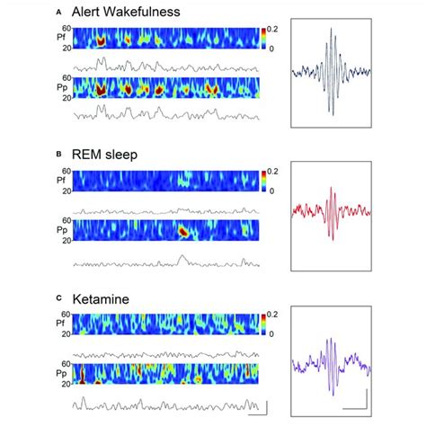 Gamma Eeg Oscillations Under The Effect Of Ketamine A Position Of