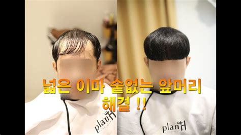 넓은 이마 숱없는 앞머리 해결 이마에 붙이는 앞머리가발 Youtube