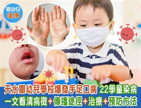 嬰幼兒健康｜小心開學病毒大爆發！養成良好衛生習慣 預防手足口病腸病毒新冠肺炎