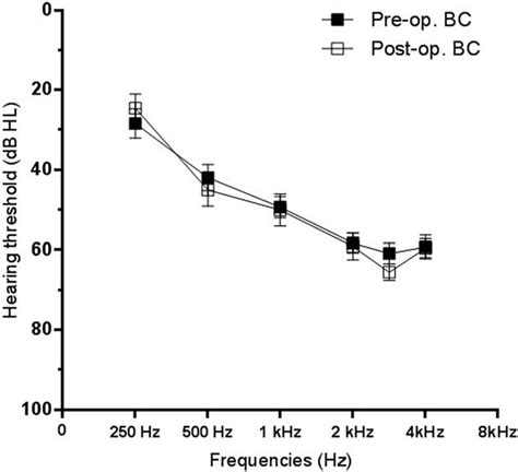 Preoperative Pre Op And Postoperative Post Op Bone Conduction