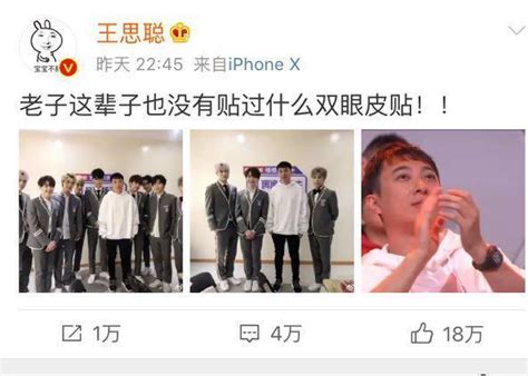 王思聪回应双眼皮贴，网友对抄袭事件不依不饶，王思聪怒怼网友明星八卦海峡网