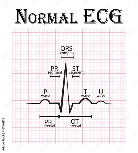 Normal Ecg Electrocardiogram P Wave Pr Segment Pr Interval Qrs Complex Qt Interval