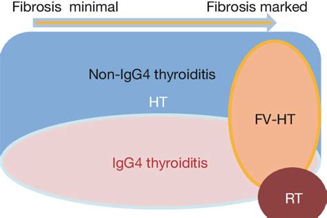 Differential Diagnosis Of Thyroiditis According To Igg4 Immunostaining Download Scientific