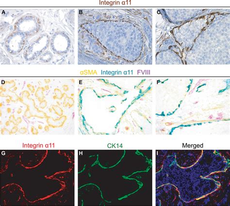 Integrin α11 Is Expressed In A Subgroup Of Breast Myoepithelial Cells
