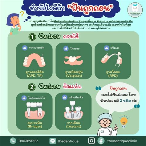 🦷 ทำอย่างไรดีถ้า ฟันถูกถอน หลายคนอาจสงสัยว่าฟันถูกถอนไปแล้วปล่อยทิ้งไว้เฉยๆได้หรือไม่