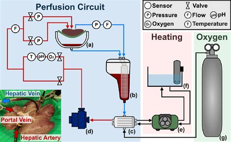Figure 1 From The Application Of Machine Perfusion As An Enhanced Ex