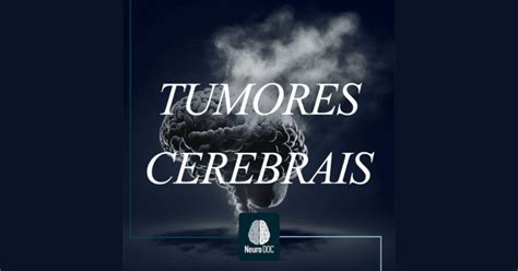 Tumores Cerebrais Uma Abordagem Detalhada e Científica Clínica NeuroDoc