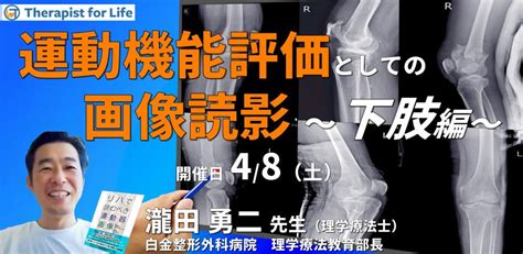 セラピストのための運動機能評価としての画像の読影（下肢編）～評価精度の向上、治療方針の明確化〜 講師：瀧田勇二先生 Peatix