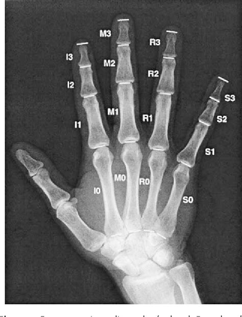 Figure 3 From The Fibonacci Sequence Relationship To The Human Hand Semantic Scholar