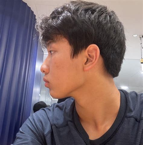 How To Fix My Side Profile Rjawsurgery
