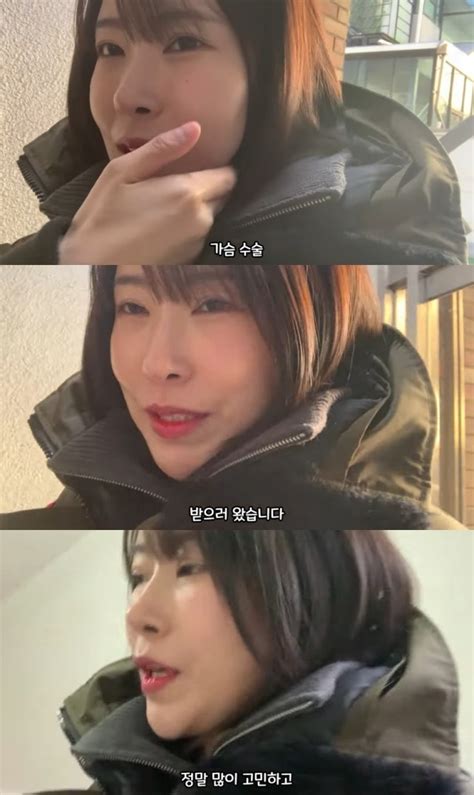 성형 고백 이세영 이번엔 가슴 수술…유륜 색 예쁘게 [영평티비]