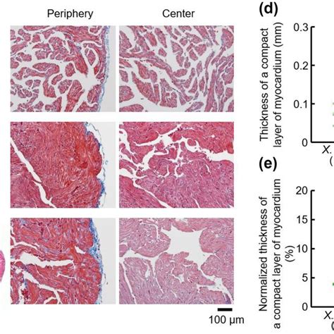 Massons Trichrome Staining Of Ventricle Sections Of Ax Laevis Bp