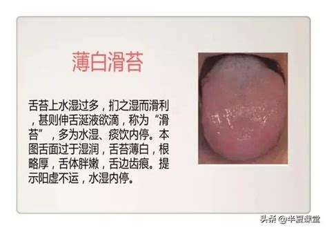 高清中医舌诊案例图不可多得强烈建议收藏 舌苔