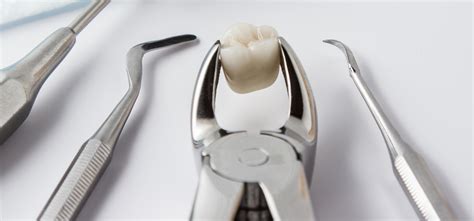 Tooth Extractions Dentistry Near Me Tooth Extractions In Dallas