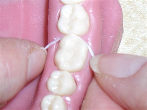 Reynolds Dentistry Flossing