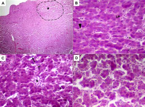 Microstructure Of Liver In Taihe Bsf Hande Micrograph A X100 Others