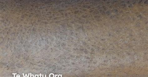 Ichthyosis Vulgaris Image