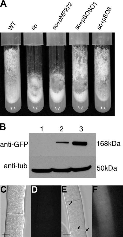 So A Protein Involved In Hyphal Fusion In Neurospora Crassa Localizes